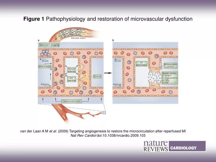 PPT - Figure 1 Pathophysiology and restoration of microvascular ...