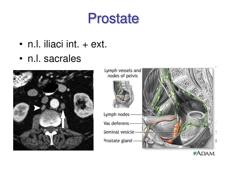 PPT - Lymph nodes and vessels PowerPoint Presentation - ID:4331486