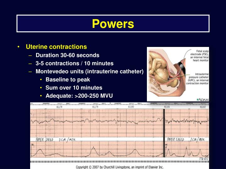 PPT - Parturition/Stages of Labor PowerPoint Presentation - ID:4340987