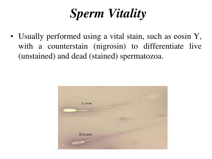 PPT - Semen analysis PowerPoint Presentation - ID:4342349