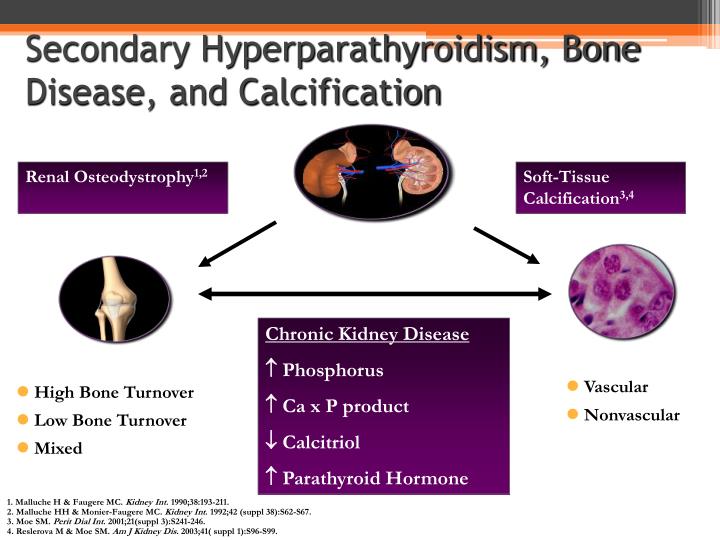 PPT - Primer for APN Nephrology Practice or CNN-NP Certification ...