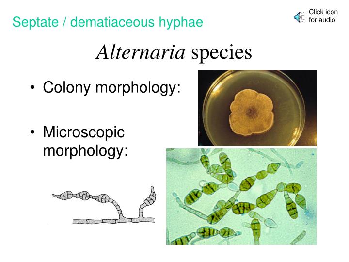 PPT - Mycology Opportunistic Molds PowerPoint Presentation - ID:4354513