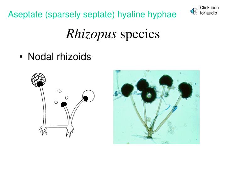 PPT - Mycology Opportunistic Molds PowerPoint Presentation - ID:4354513