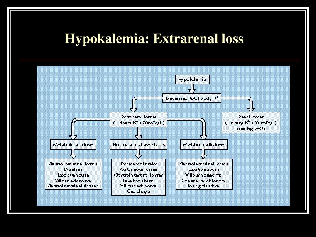 Ppt Hypokalemia Powerpoint Presentation Free Download Id 4355252