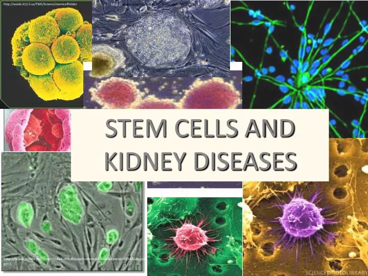 PPT - STEM CELLS AND KIDNEY DISEASES PowerPoint Presentation, free ...