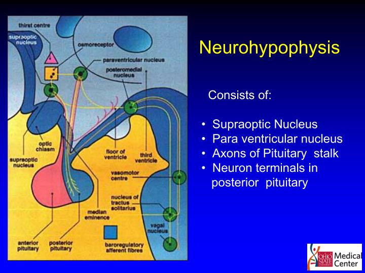 PPT - Hyponatremia Management PowerPoint Presentation - ID:4356690