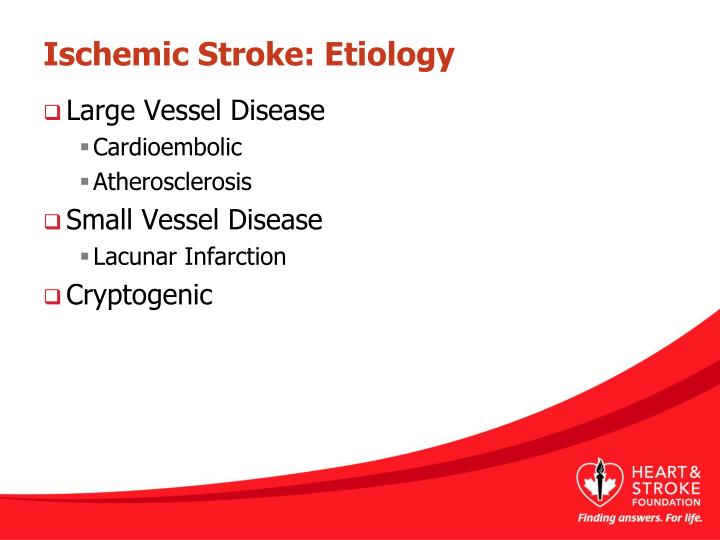 PPT - Types of Stroke PowerPoint Presentation - ID:4357751