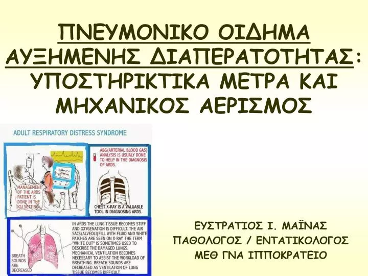 PPT - ΠΝΕΥΜΟΝΙΚΟ ΟΙΔΗΜΑ ΑΥΞΗΜΕΝΗΣ ΔΙΑΠΕΡΑΤΟΤΗΤΑΣ : ΥΠΟΣΤΗΡΙΚΤΙΚΑ ΜΕΤΡΑ ...