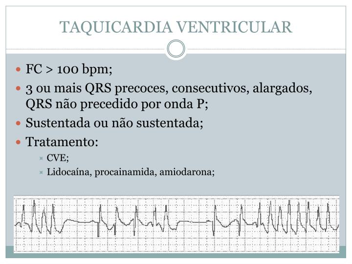 PPT - ARRITMIAS CADÍACAS PowerPoint Presentation - ID:4361733