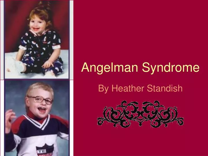 PPT - Angelman Syndrome PowerPoint Presentation, free download - ID:4363857