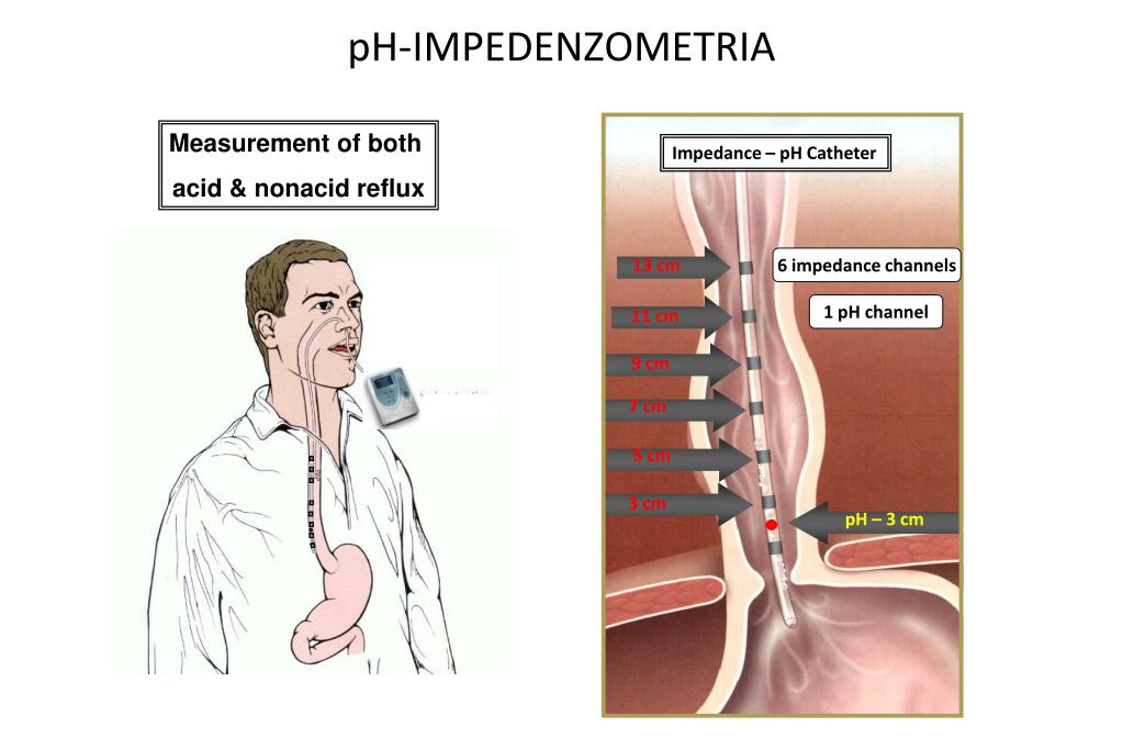 PPT - La Diagnostica Gastroenterologica per il Pediatra PowerPoint ...