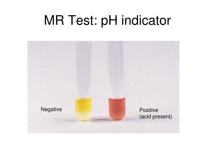 PPT - Gram Negative Rods PowerPoint Presentation - ID:4367539