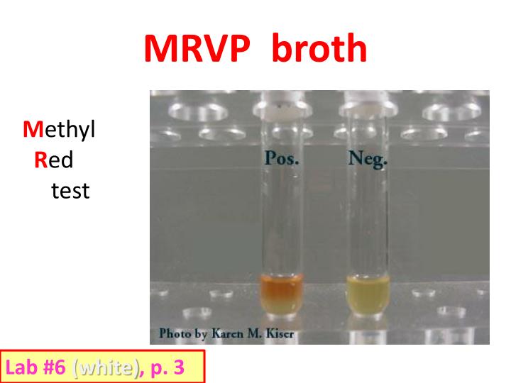 PPT - IMViC tests PowerPoint Presentation - ID:4367569