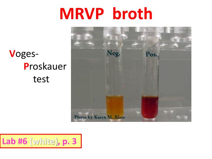PPT - IMViC tests PowerPoint Presentation - ID:4367569