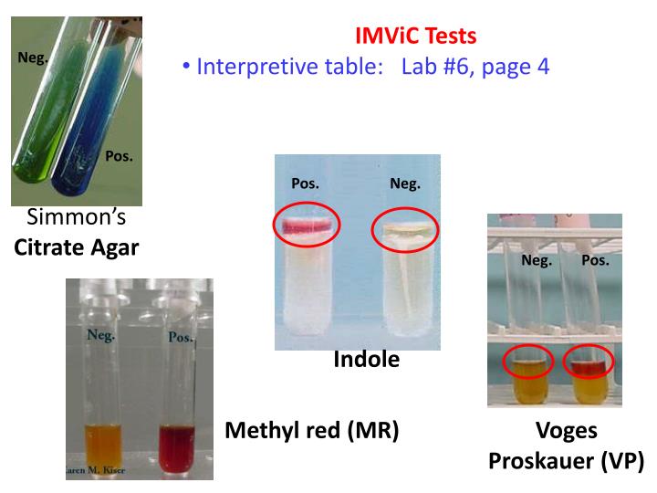 PPT - IMViC tests PowerPoint Presentation - ID:4367569
