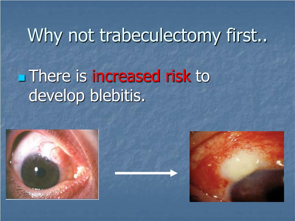 PPT - Corneal Graft Followed By Enhanced Medical Therapy Or ...