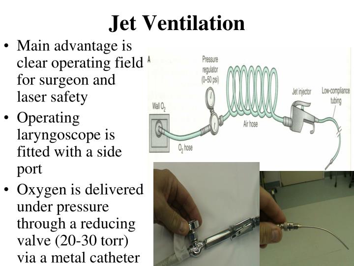 PPT - Laser Surgery of the Airway PowerPoint Presentation - ID:4378408