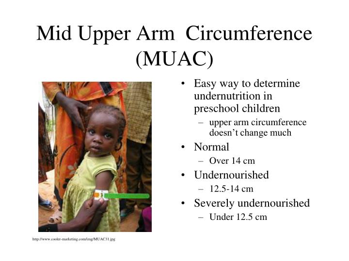 PPT - Measuring Undernutrition PowerPoint Presentation - ID:4379953