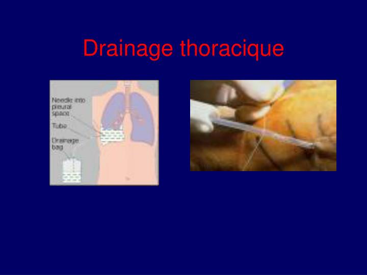 PPT - Appareil Respiratoire PowerPoint Presentation - ID:4380884