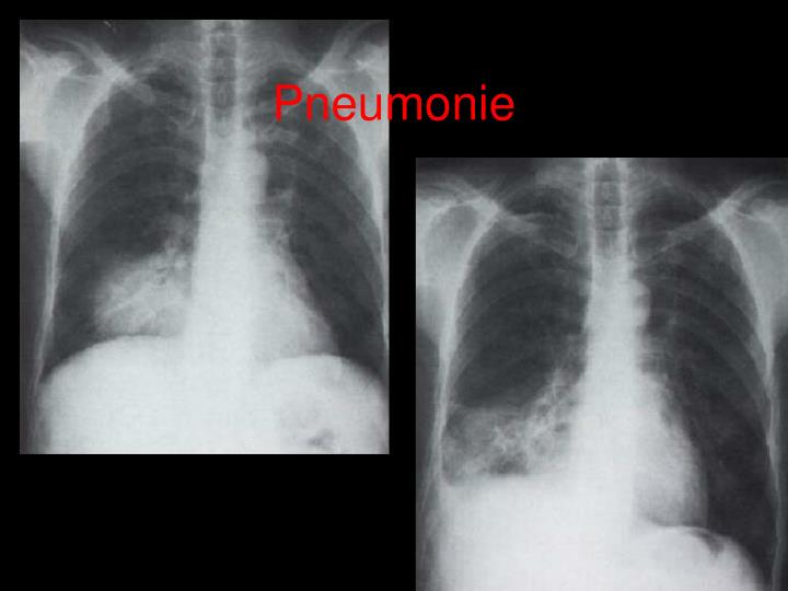 PPT - Appareil Respiratoire PowerPoint Presentation - ID:4380884