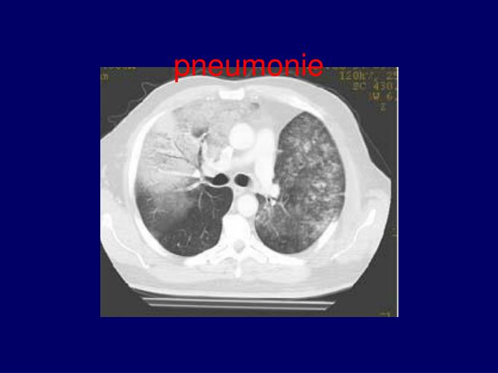 PPT - Appareil Respiratoire PowerPoint Presentation - ID:4380884