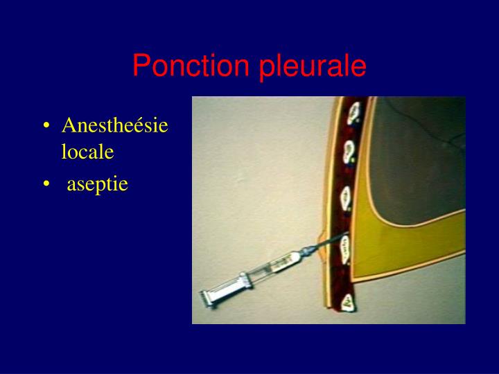 PPT - Appareil Respiratoire PowerPoint Presentation - ID:4380884