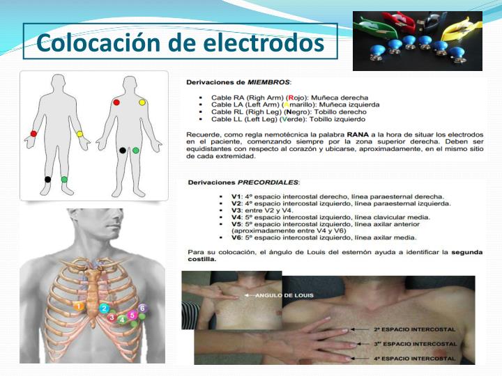 PPT - Lectura e interpretación del electrocardiograma PowerPoint ...