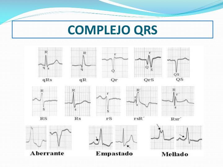PPT - Lectura e interpretación del electrocardiograma PowerPoint ...