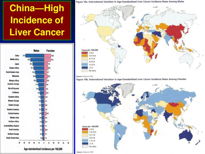 PPT - Interventional Treatment for Hepatocellular Carcinoma PowerPoint ...