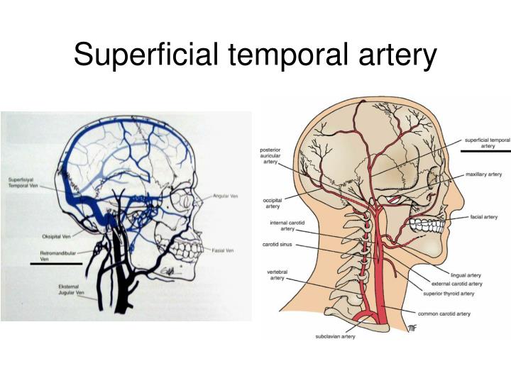 Superficial Temporal Artery Branches