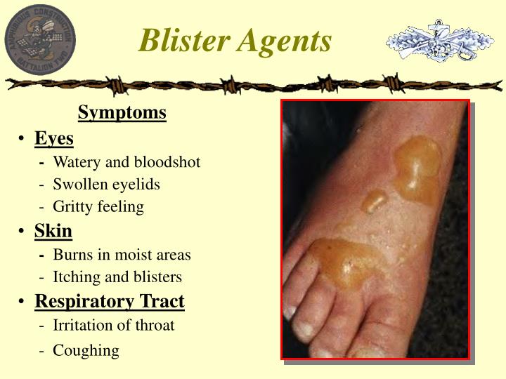 PPT - SEABEE COMBAT WARFARE PowerPoint Presentation - ID:4395802