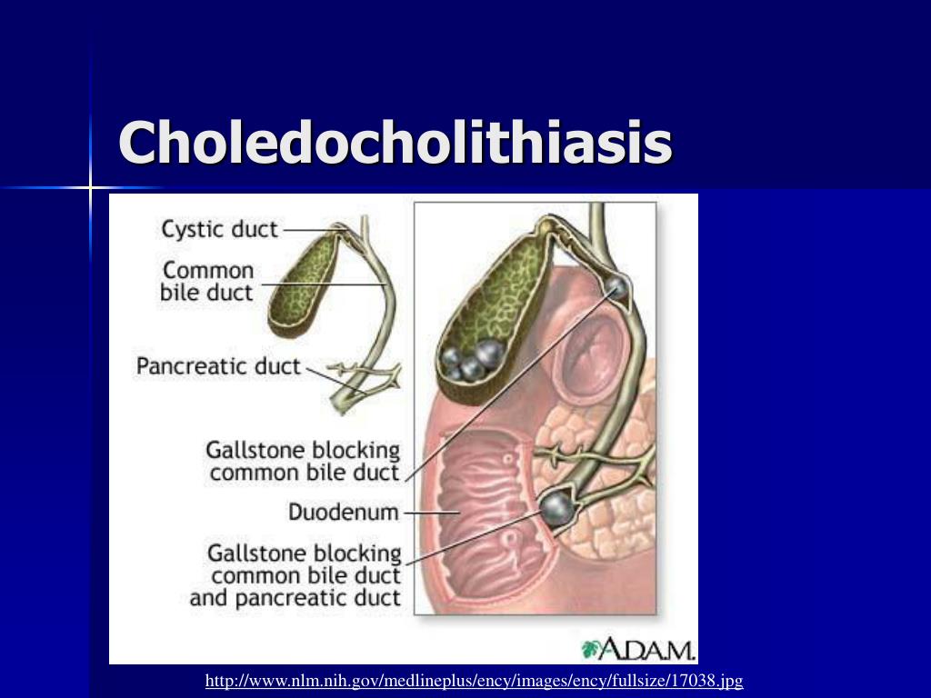 PPT - Medical Nutrition Therapy for Liver, Biliary System, and Exocrine ...