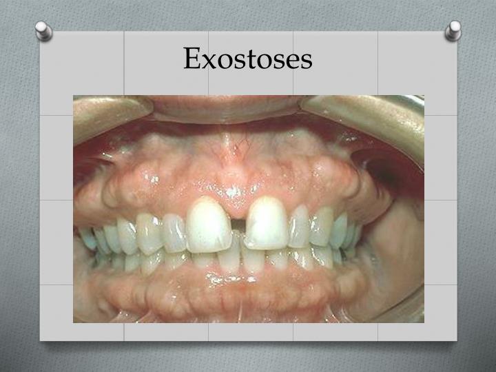 PPT - Anomalies et malformations congénitales PowerPoint Presentation ...