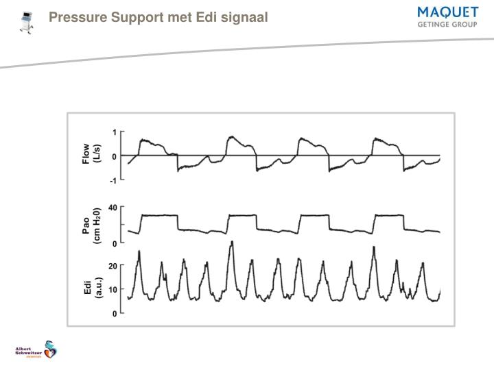 PPT - NAVA Neurally Adjusted Ventilatory Assist PowerPoint Presentation ...