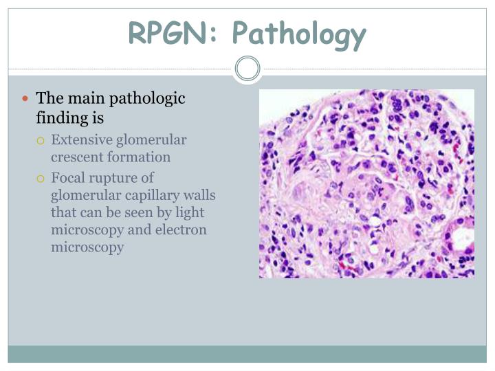 PPT - Introduction to nephrology Acute and chronic glomerulonephritis ...