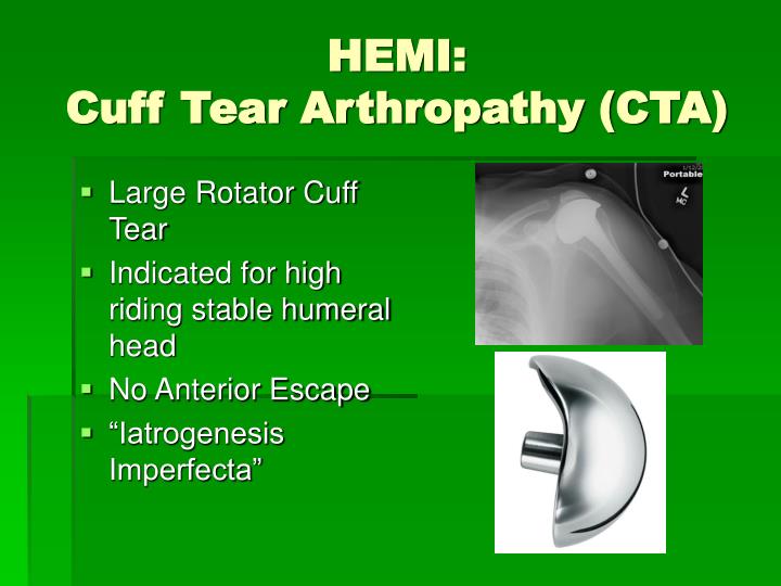 PPT - Shoulder Arthroplasty PowerPoint Presentation - ID:4419492