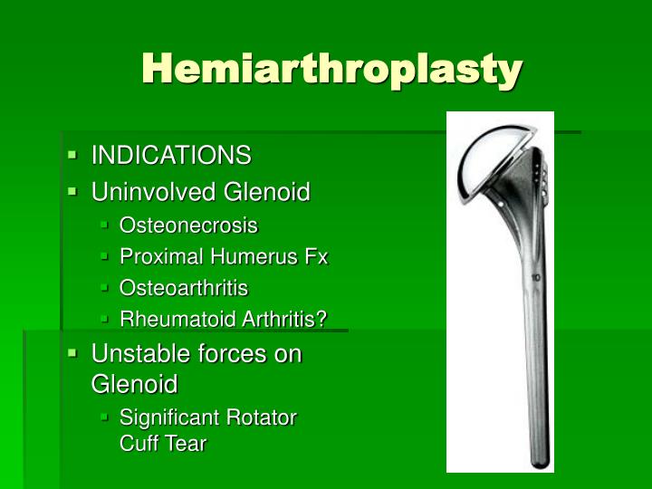 PPT - Shoulder Arthroplasty PowerPoint Presentation - ID:4419492