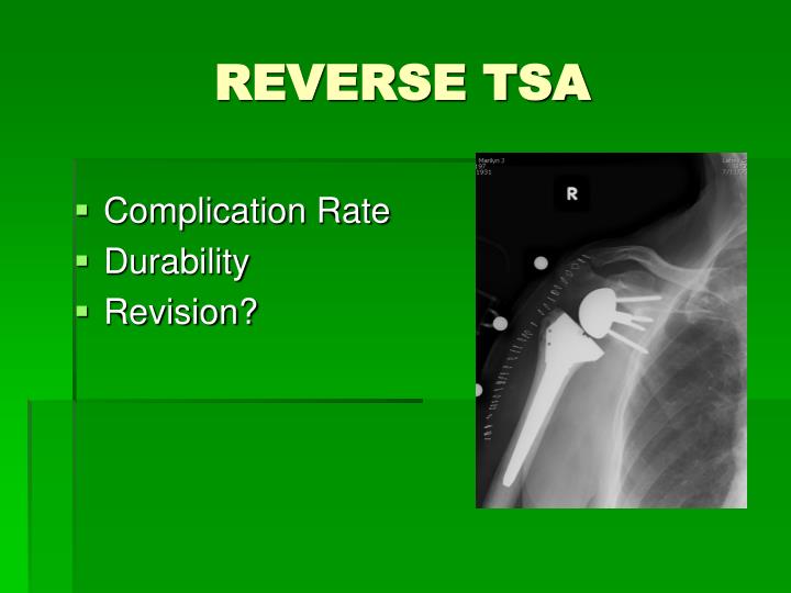 PPT - Shoulder Arthroplasty PowerPoint Presentation - ID:4419492
