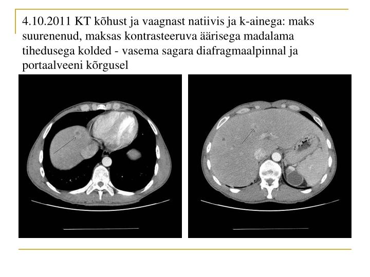 PPT - Haigusjuht PowerPoint Presentation - ID:4420330