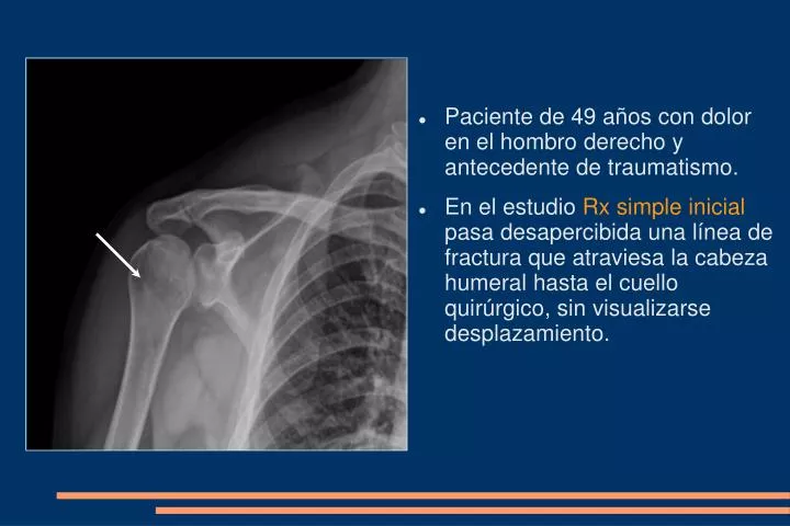 PPT - Paciente de 49 años con dolor en el hombro derecho y antecedente ...