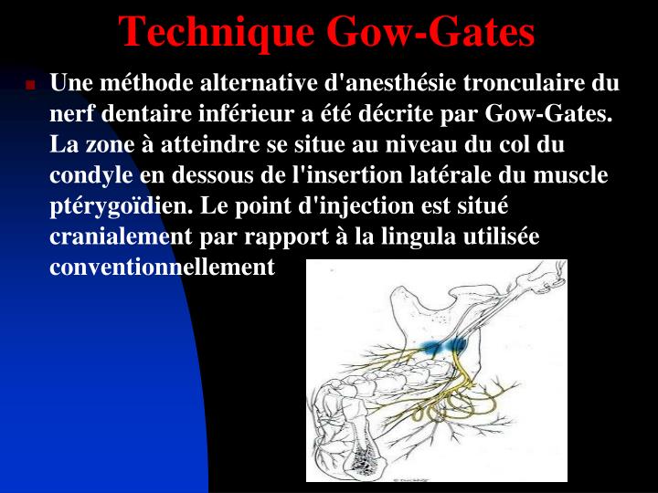PPT - L’anesthésie locorégionale PowerPoint Presentation - ID:4423573