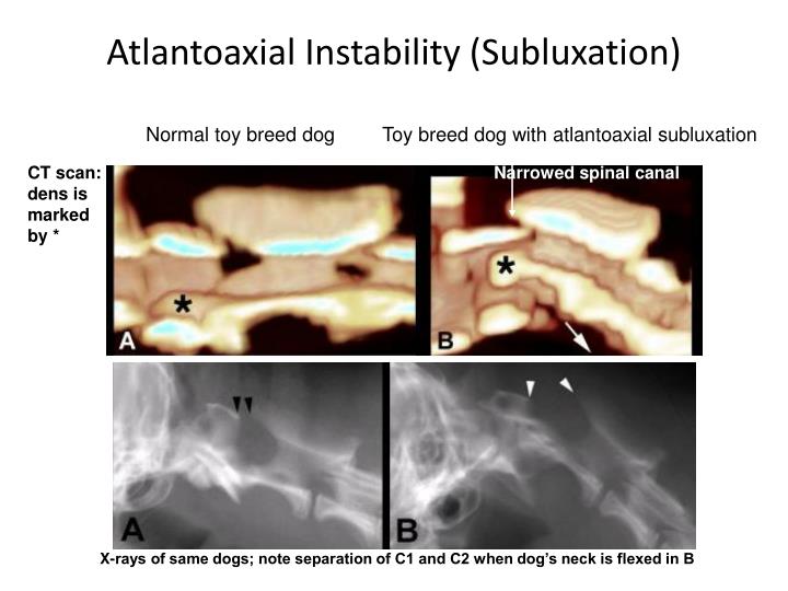 PPT - ATLANTOAXIAL INSTABILITY PowerPoint Presentation - ID:4423857