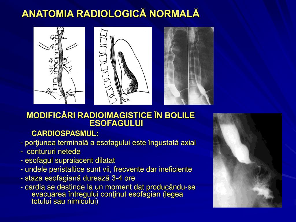PPT - EXAMENUL RADIOIMAGISTIC AL TUBULUI DIGESTIV PowerPoint ...