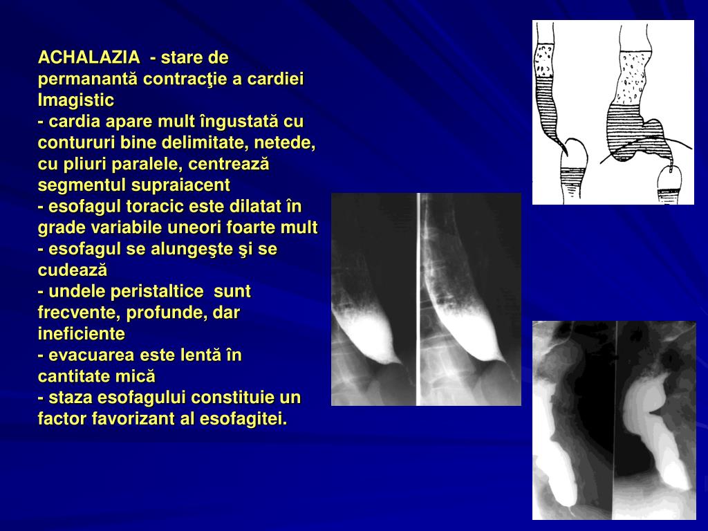 PPT - EXAMENUL RADIOIMAGISTIC AL TUBULUI DIGESTIV PowerPoint ...