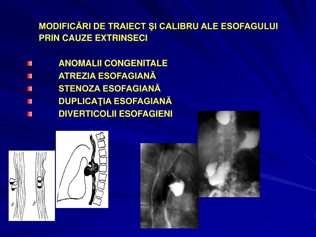 PPT - EXAMENUL RADIOIMAGISTIC AL TUBULUI DIGESTIV PowerPoint ...