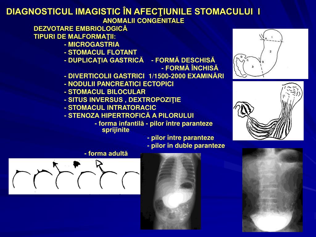 PPT - EXAMENUL RADIOIMAGISTIC AL TUBULUI DIGESTIV PowerPoint ...