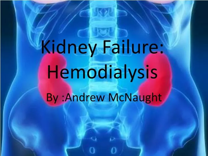 PPT - Kidney Failure: Hemodialysis PowerPoint Presentation, free ...