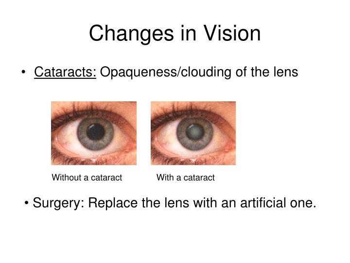 PPT - Lecture 2: Biological Aging PowerPoint Presentation - ID:4445513