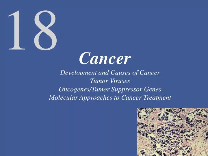 PPT - Types of Cancer PowerPoint Presentation, free download - ID:4447896