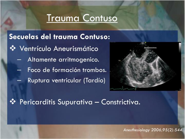 PPT - Trauma Cardiaco PowerPoint Presentation - ID:4449575